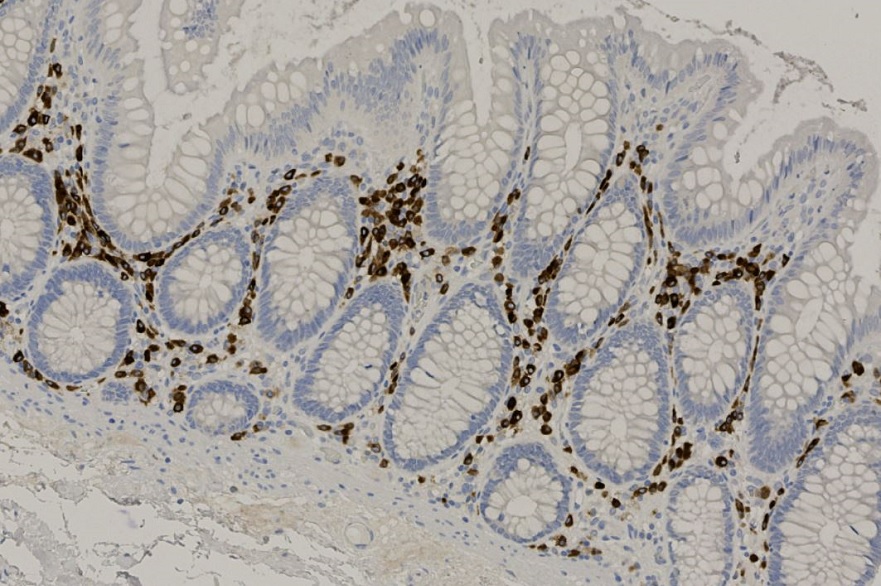 CD79a – Sakura BioSciences & Innovations