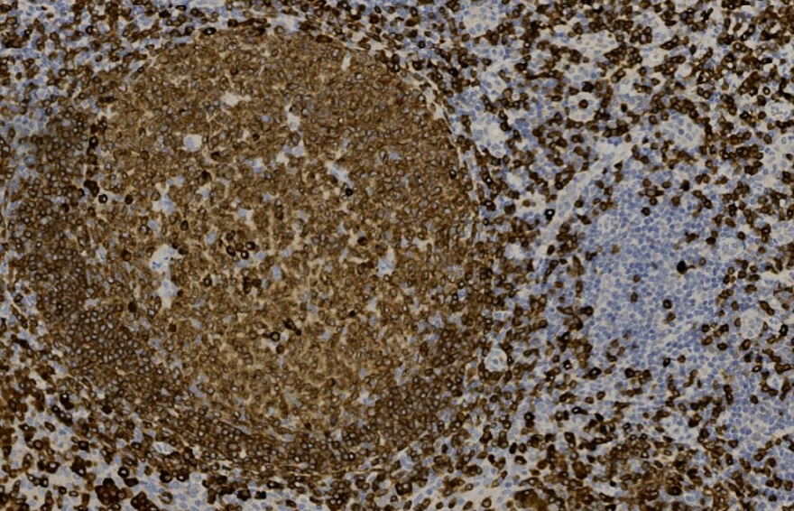 CD79a – Sakura BioSciences & Innovations