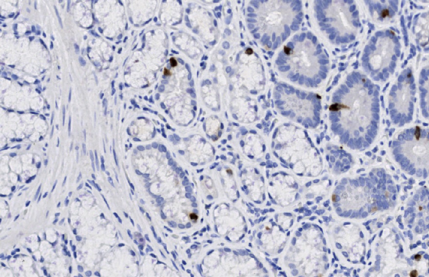 Gastrin – Sakura BioSciences & Innovations