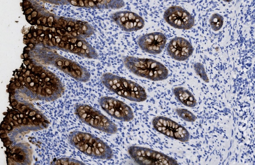 CEA – Sakura BioSciences & Innovations