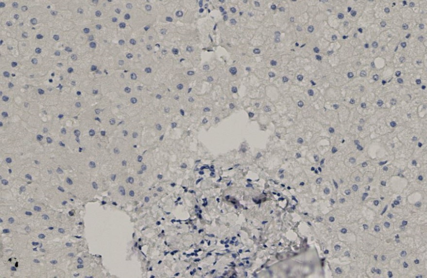 Cytokeratin 20 – Sakura BioSciences & Innovations