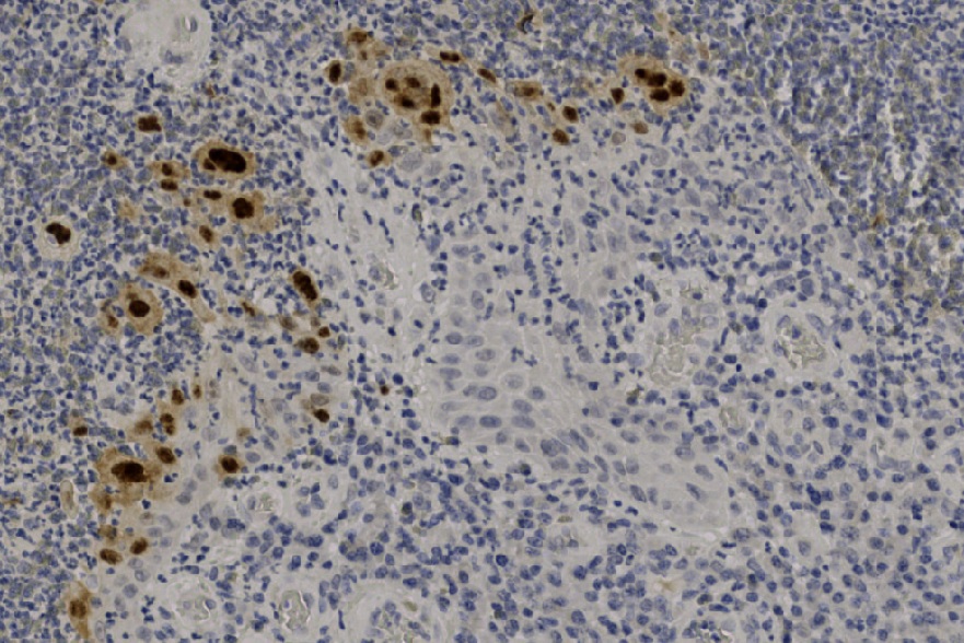 Herpes Simplex Virus 1 (HSV1) – Sakura BioSciences & Innovations