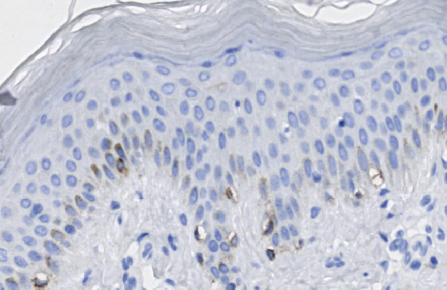 Melan A – Sakura BioSciences & Innovations