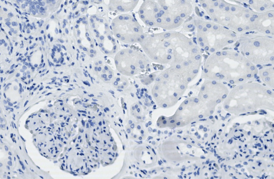 Melan A – Sakura BioSciences & Innovations