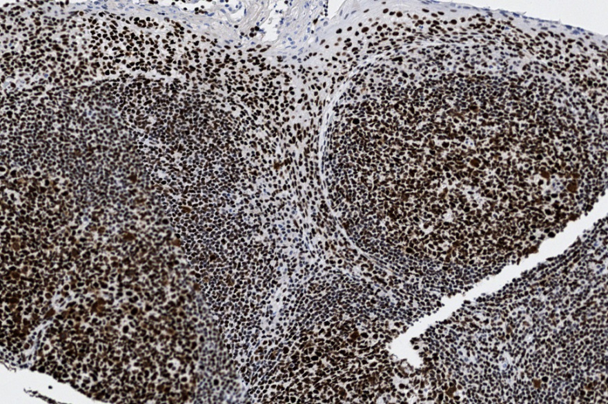 PMS2 – Sakura BioSciences & Innovations