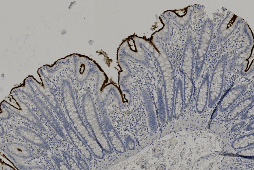 Treponema Pallidum – Sakura BioSciences & Innovations