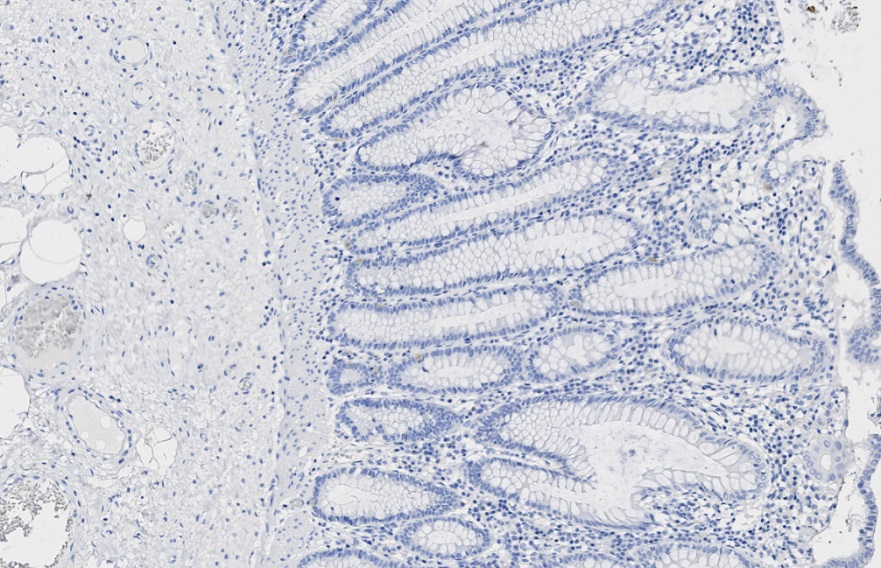 Napsin A – Sakura BioSciences & Innovations