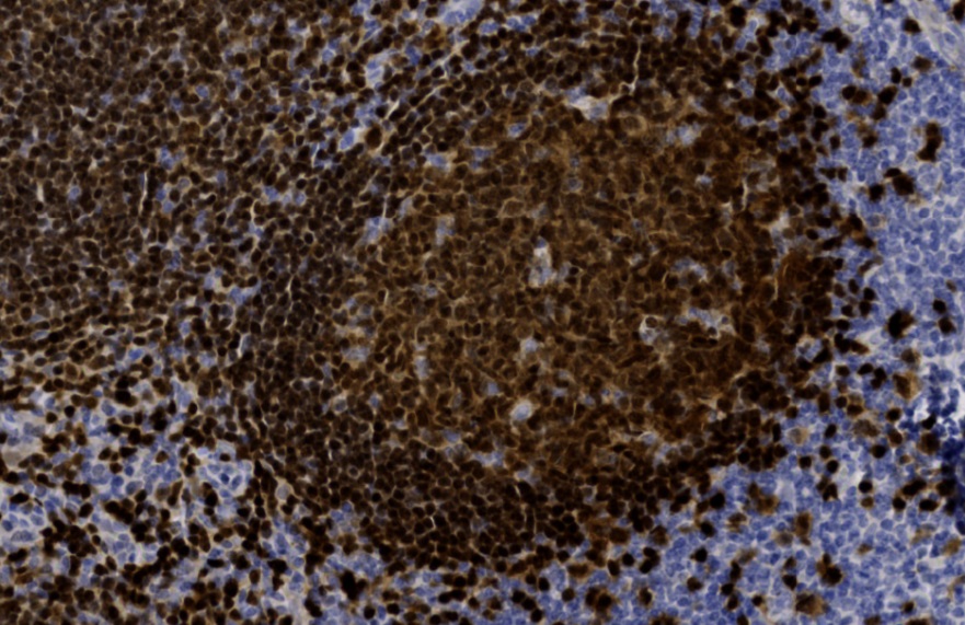 PAX5 – Sakura BioSciences & Innovations