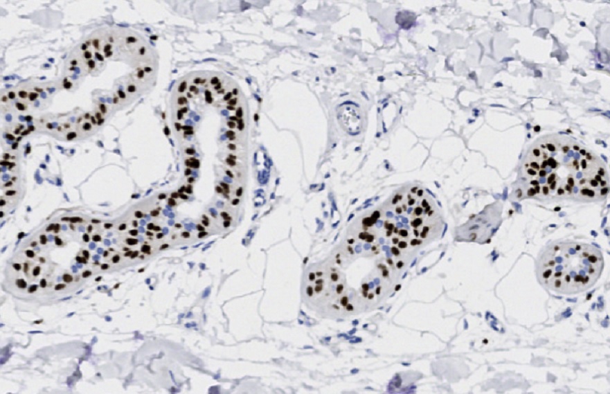 SOX10 – Sakura BioSciences & Innovations