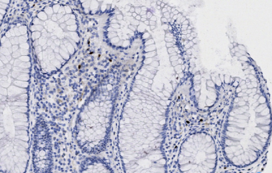 SOX10 – Sakura BioSciences & Innovations